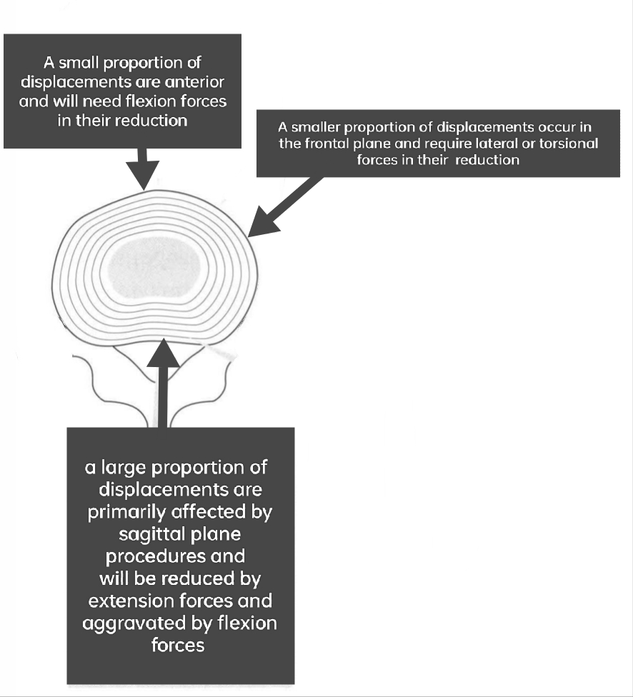 Role of MRI in spine physical therapy practice. - Orthopaedic Manipulation