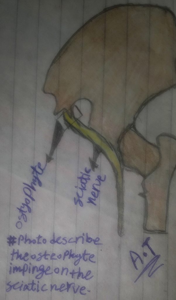 The Painful Sacroiliac Joint - Orthopaedic Manipulation