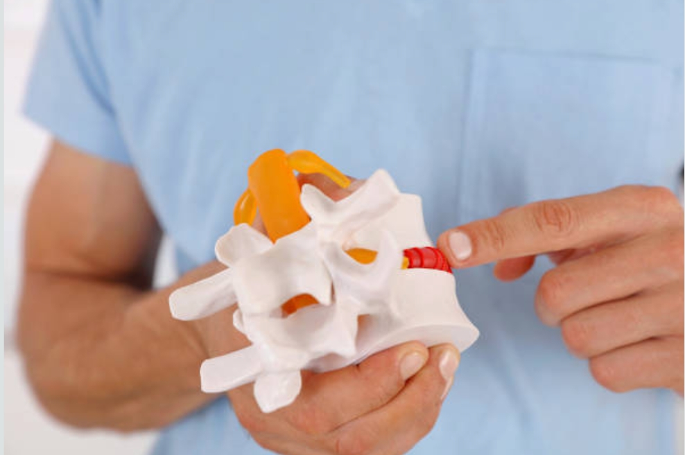 Nonreducible discogenic back pain Archives - Orthopaedic Manipulation