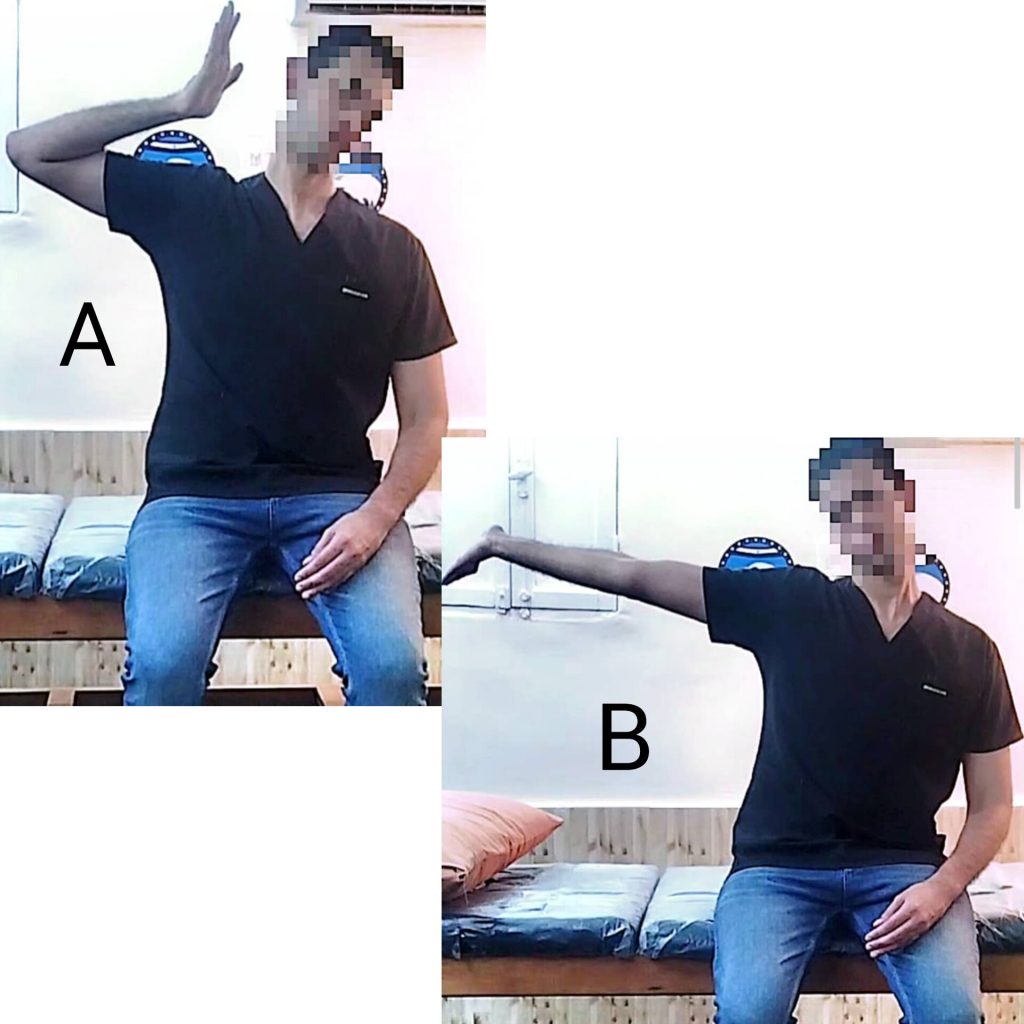 Neurodynamics management - Orthopaedic Manipulation