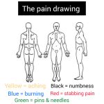 The pain drawing and Measurement of pain intensity - Orthopaedic ...