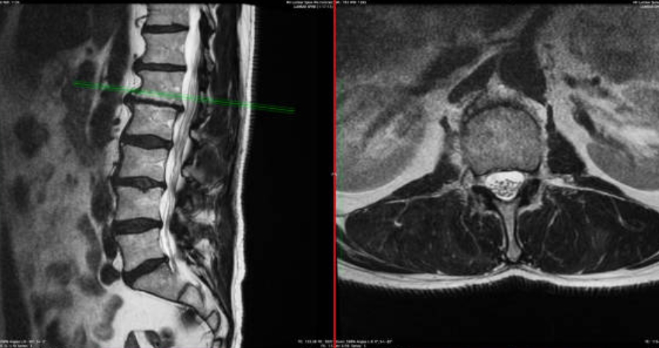 Decoding Disc Displacements: Key Insights from Research on Diagnosis ...