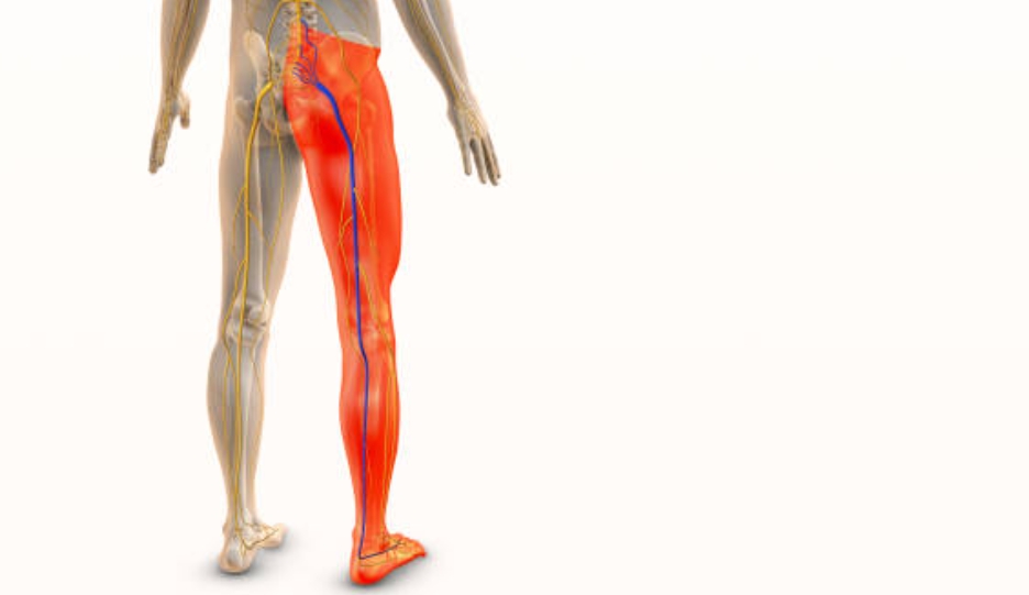 Understanding Radicular Pain: Pathophysiology and Potential Treatments ...